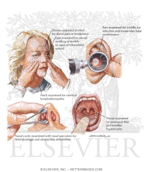 Physical Examination In Rhinitis