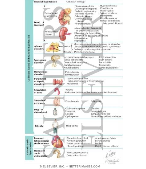 Watermarked preview of labeled image: Causes of Hypertension
