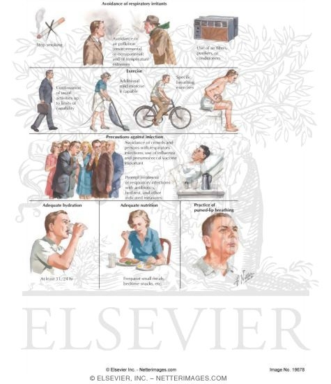 General Measures in Management of Chronic Obstructive Pulmonary Disease