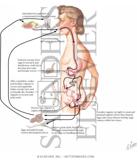 enterobius egg label