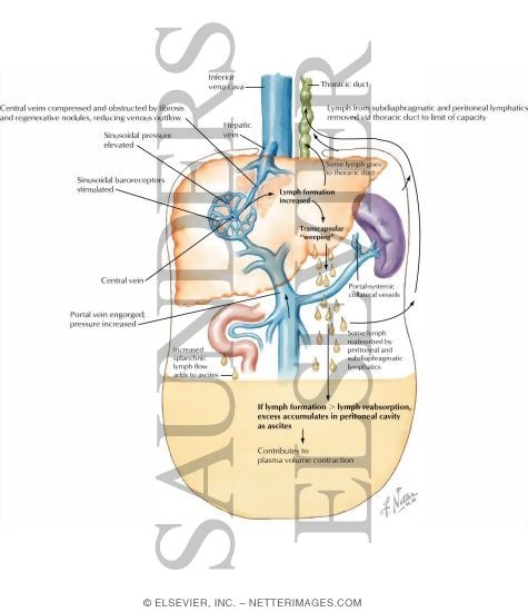 Pathophysiology of Ascites Formation