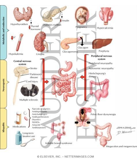 Causes of Constipation