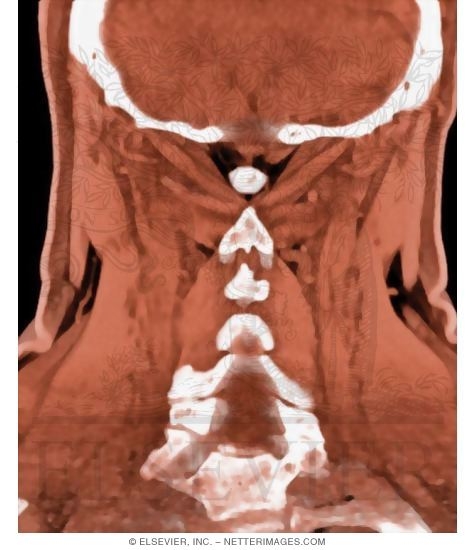 Suboccipital Triangle