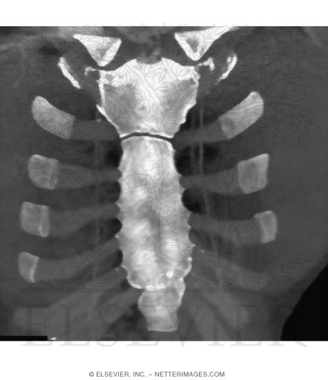 Lateral Thoracic Artery Cadaver