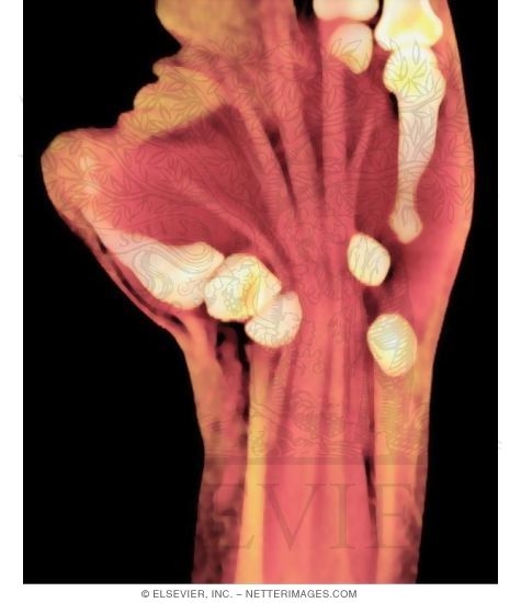 Flexor Muscles of the Wrist