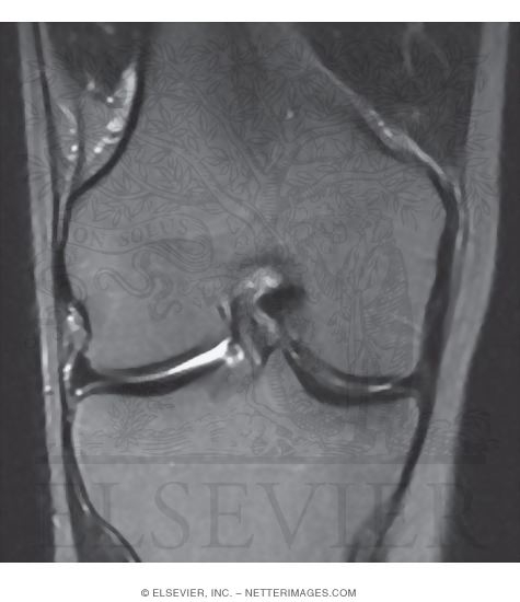 Knee Joint, Anterior View