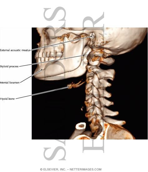 Watermarked preview of labeled image: Upper Neck, Lower Head Osteology