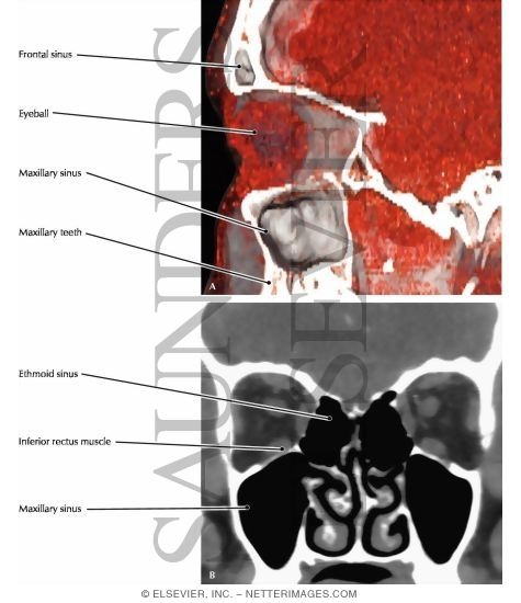 Maxillary Sinus