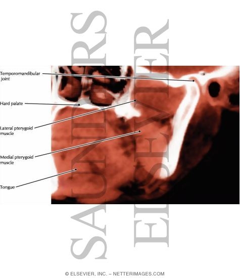 Pterygoid Muscles