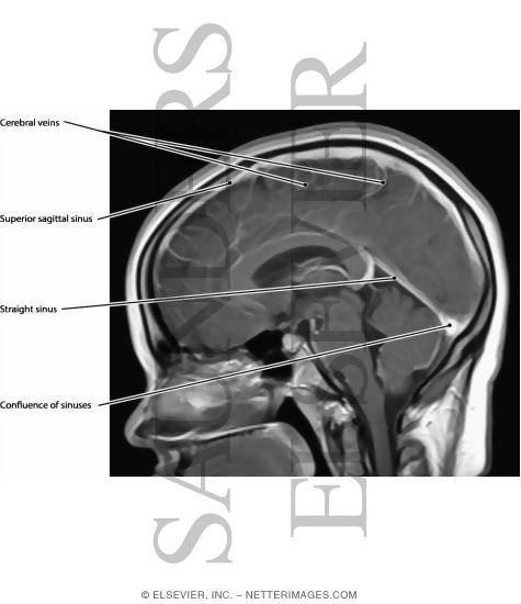 Cerebral Venous System