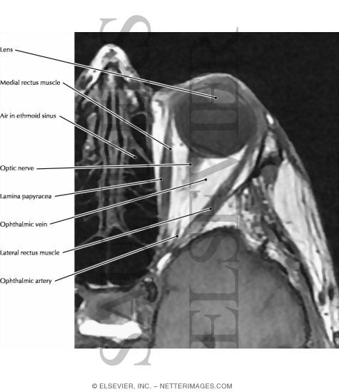 Netter's Concise Radiologic Anatomy