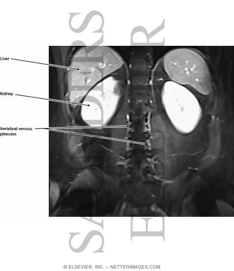Vertebral Venous Plexuses