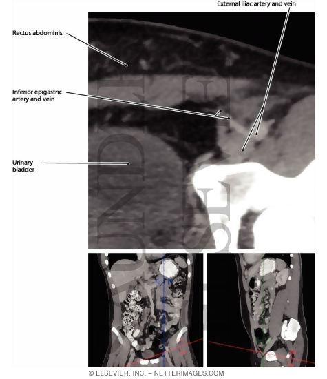 Inguinal Region