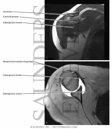 Subscapularis Muscle
