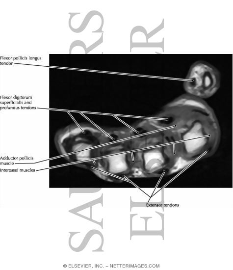 Hand, Axial Section