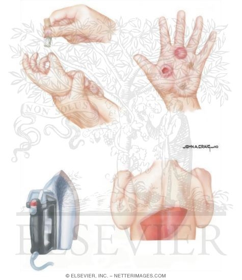 Welcome To Netter Images