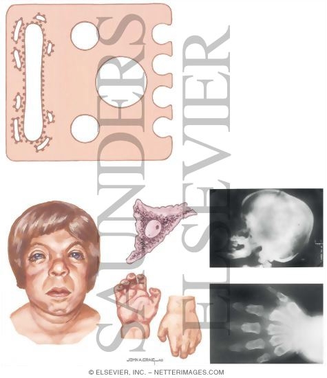 Welcome To Netter Images