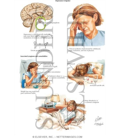 Depression (Unipolar)