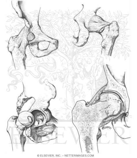 joint coloring pages