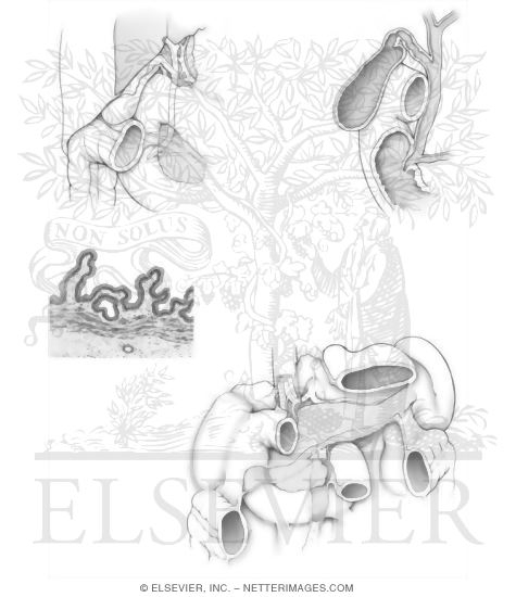 gallbladder coloring pages