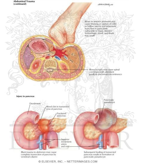 pediatric abdominal trauma