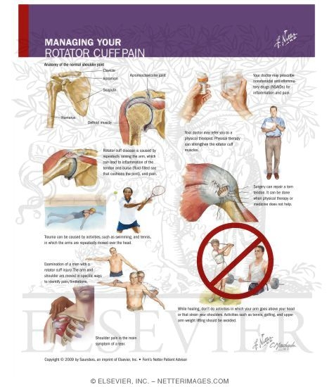 Managing Your Rotator Cuff Pain