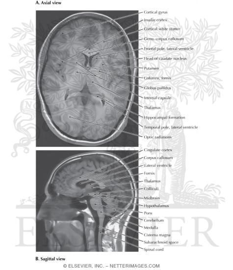 Magnetic Resonance Imaging Mri Axial T1weighted Images