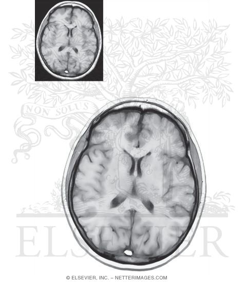 Axial (Horizontal) Sections Through the Forebrain: Level 7 - Basal ...