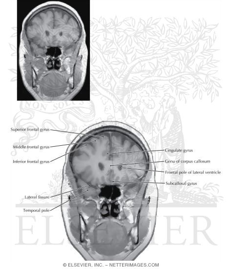 Coronal Sections Through the Forebrain: Level 1 - Genu of Corpus Callosum