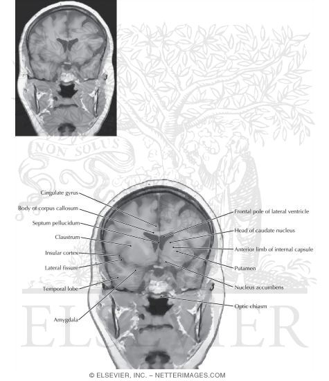 caudate nucleus coronal