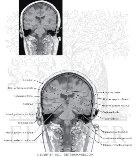 Coronal Sections Through the Forebrain: Level 7 - Midthalamus