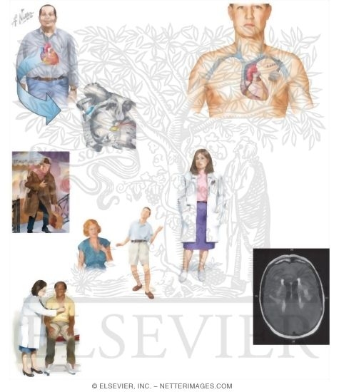 Managing Your Complete Heart Block