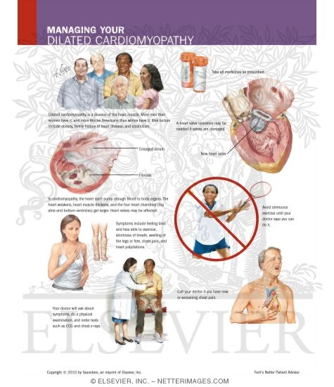 Dilated Cardiomyopathy And Myocardial Infarction