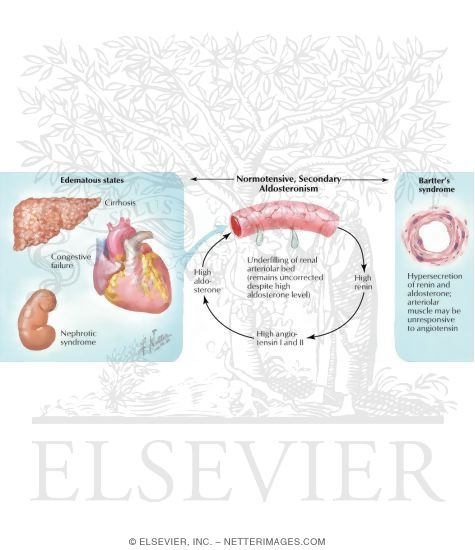 Normotensive Secondary Aldosteronism