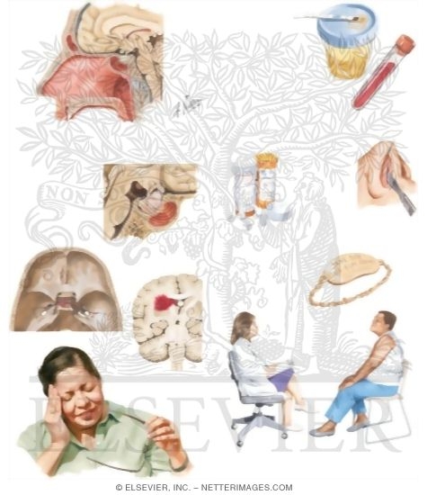 Managing Your Hypopituitarism