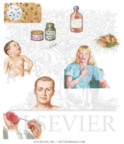 Managing Your Botulism