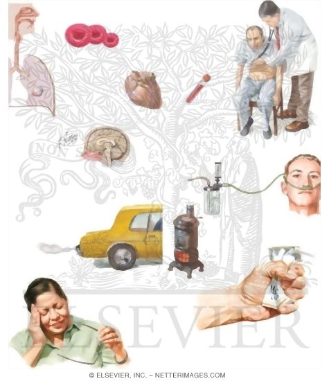 Managing Your Carbon Monoxide Poisoning