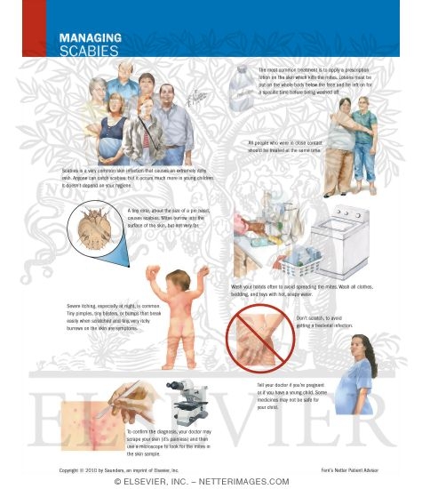 Managing Scabies