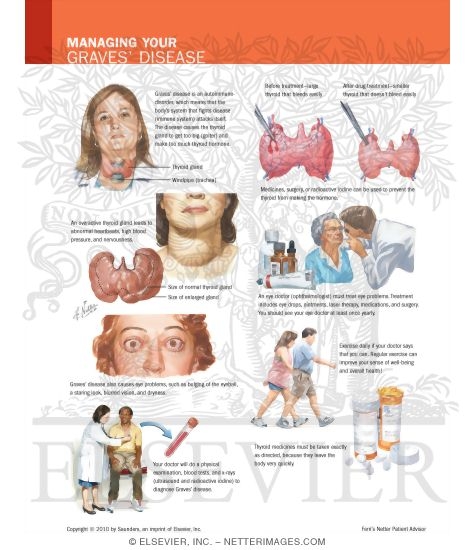 Managing Your Graves' Disease
