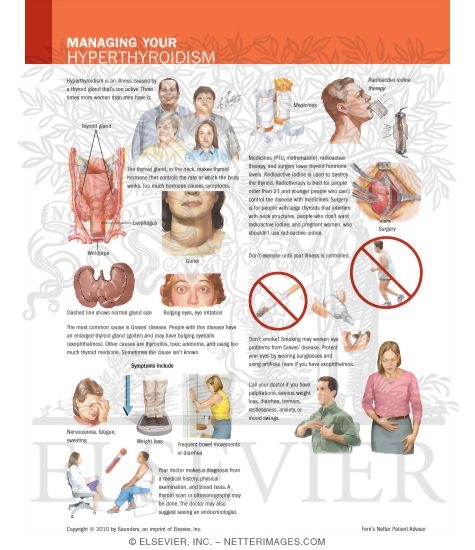 Managing Your Hyperthyroidism
