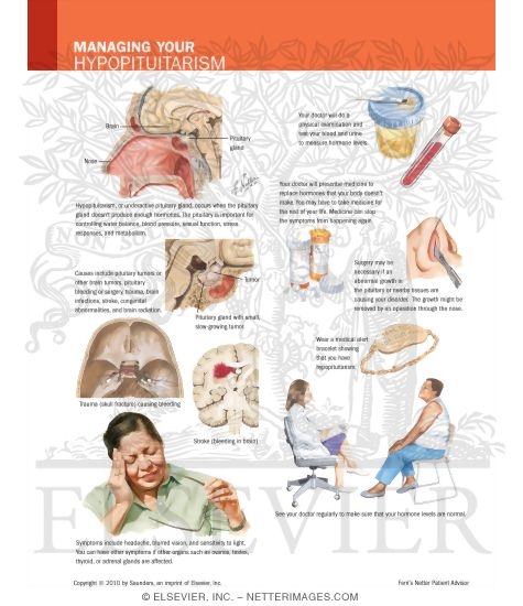 Managing Your Hypopituitarism