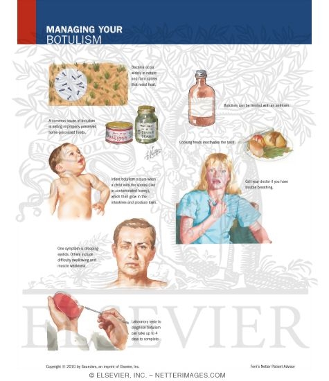 Welcome To Netter Images