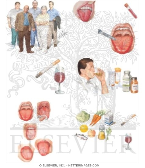 Managing Your Glossitis