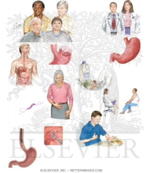 Managing Your Stomach Cancer