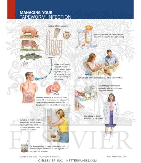 Managing Your Tapeworm Infection