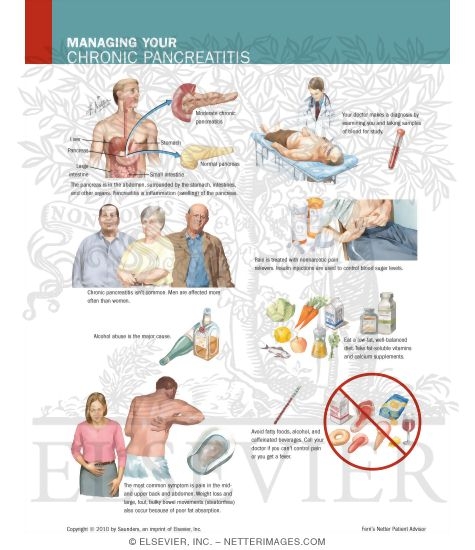 Managing Your Chronic Pancreatitis