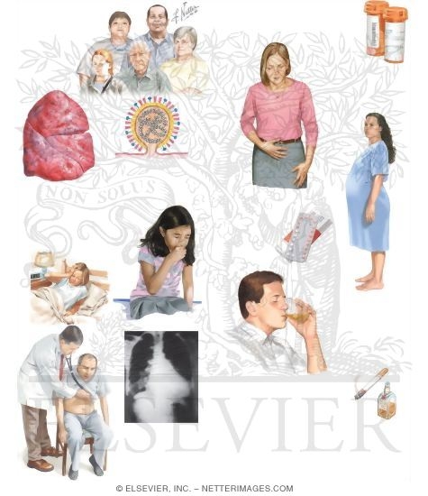 Managing Your Viral Pneumonia