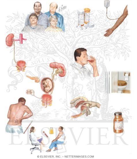 Managing Your Pyelonephritis