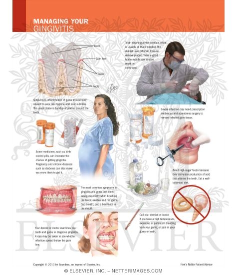 Managing Your Gingivitis