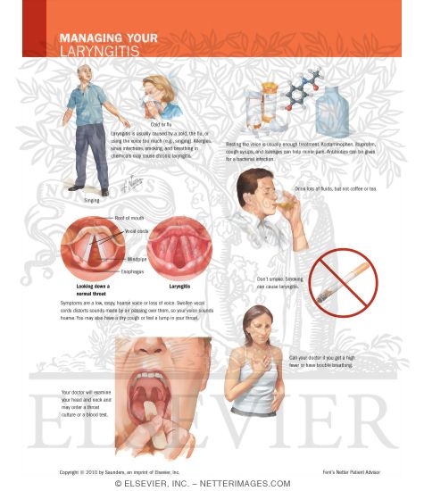 Managing Your Laryngitis